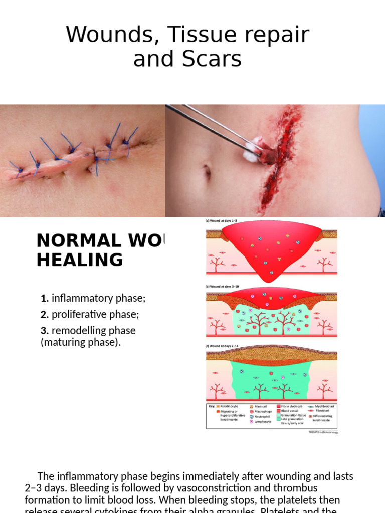 Wounds, Tissue Repair and Scars (General Surgery) | PDF | Healing | Scar