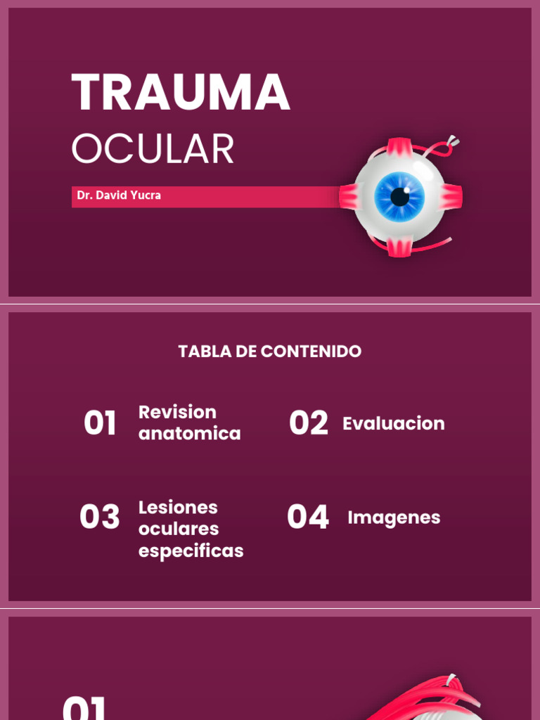 Trauma Ocular | PDF | Ojo humano | Ojo