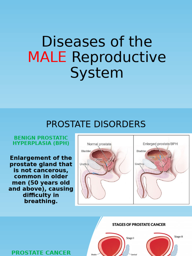 LESSON 3. Diseases of The Reproductive System | PDF | Polycystic Ovary ...