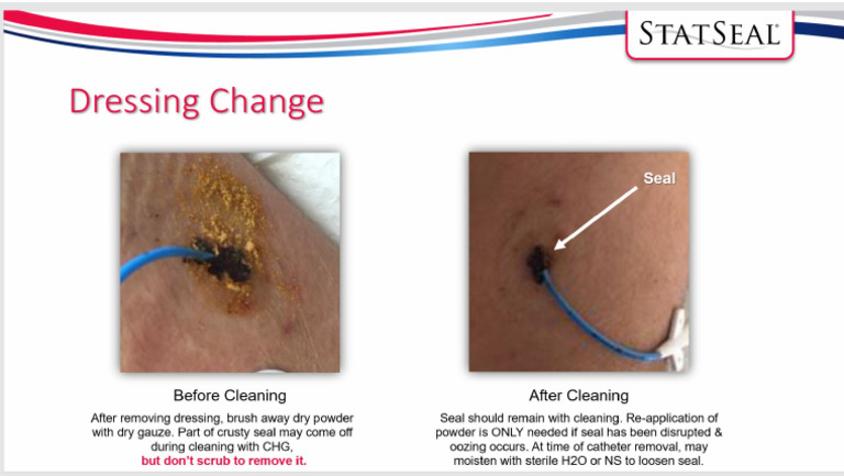 A StatSeal With Dressing Change | PDF