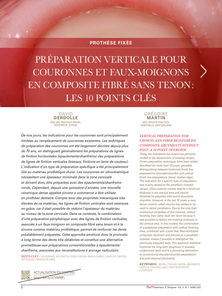 Vertical Crown Prep with Fiber Abutments | PDF | Dental Implant | Materials
