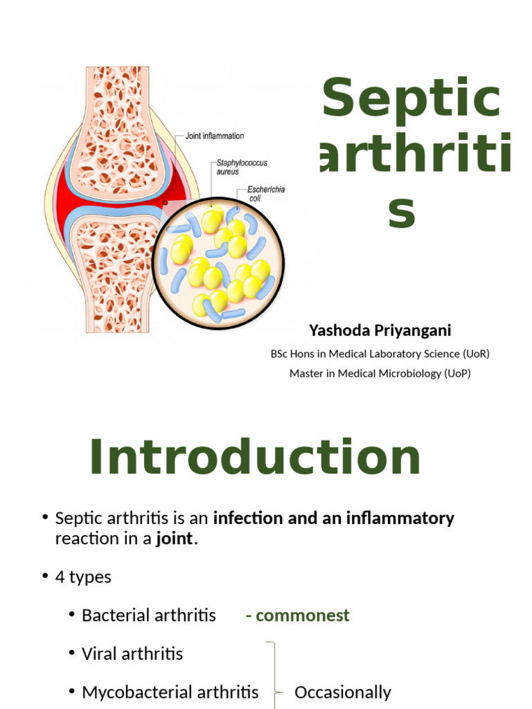 Understanding Septic Arthritis: Causes & Treatment | PDF | Infection ...