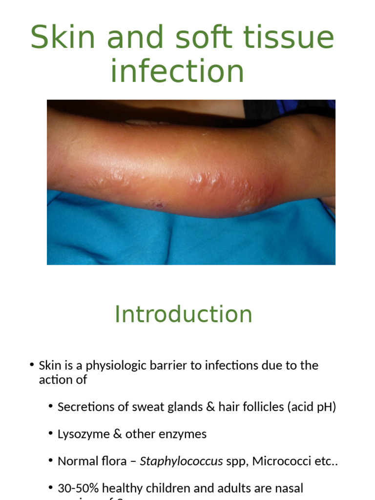 Skin and Soft Tissue Infections Overview | PDF | Staphylococcus Aureus ...