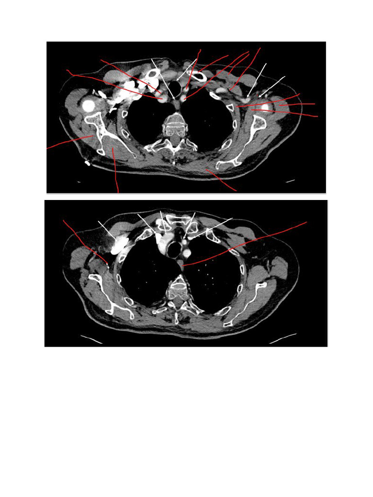 Anat Radio Thorax | PDF