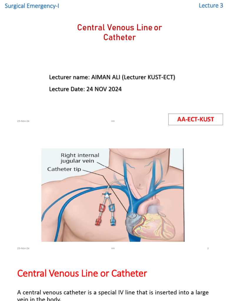 SEL3 - Central Venous Line or | PDF | Vein | Cardiovascular System
