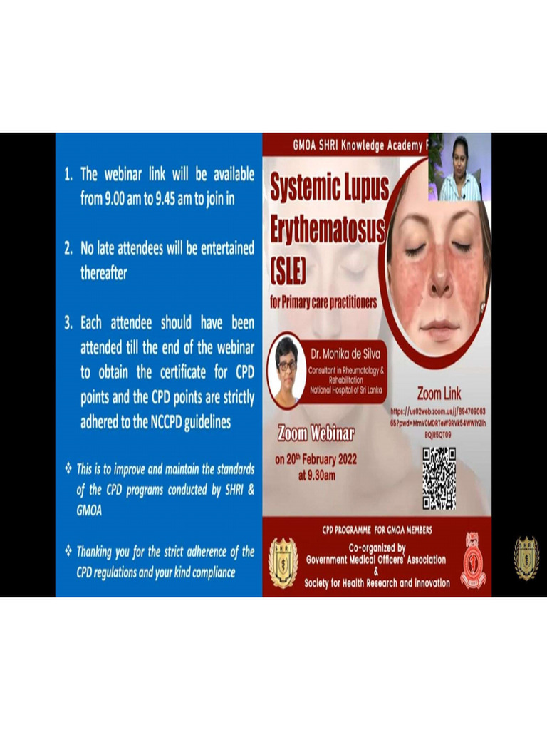 overview of SLE | PDF