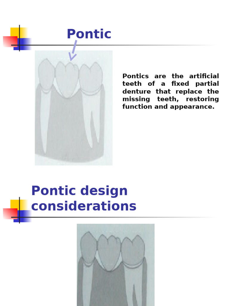 pontic design | PDF | Dentistry Branches | Mouth