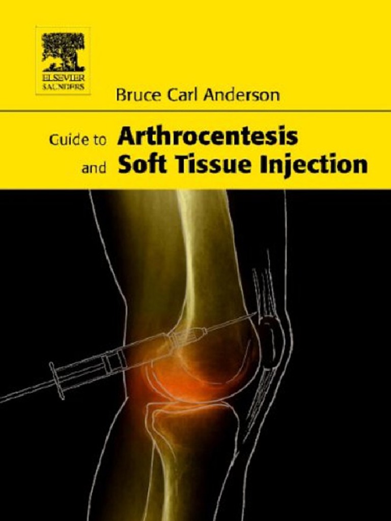 Arthrocentesis and Soft Tissue Injection | Shoulder | Injection (Medicine)