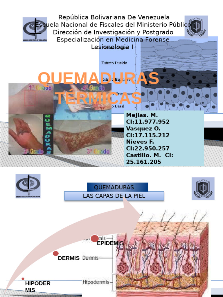 Quemaduras Enfmp | PDF | Quemar | Piel