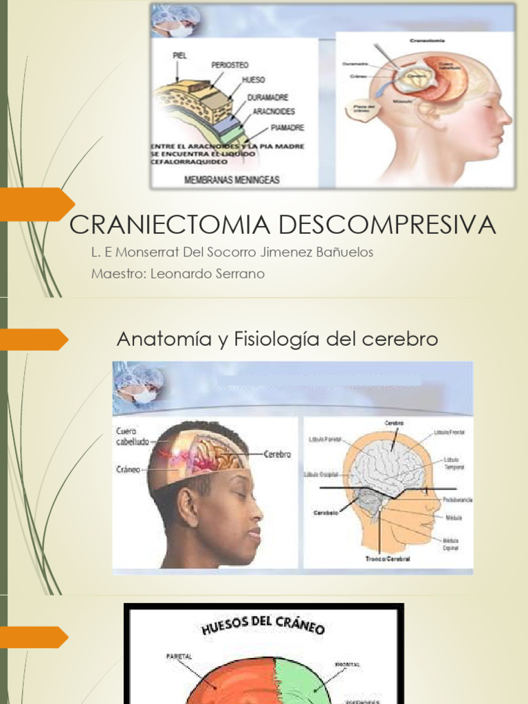 Craniectomia | PDF | Lesión cerebral traumática | Cirugía