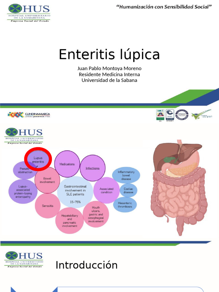 Enteritis Lúpica: Diagnóstico y Manejo | PDF | Especialidades Medicas ...