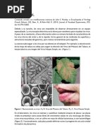 Tratamiento Dermatitis Atópica GPC | PDF | Alergia | Inmunología