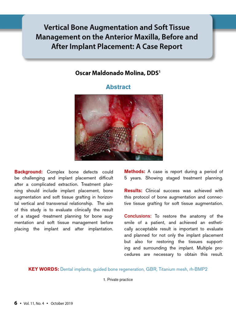 VERTICAL BONE AUGMENTATION AND SOFT TISSUE MANAGEMENT | PDF | Dental ...