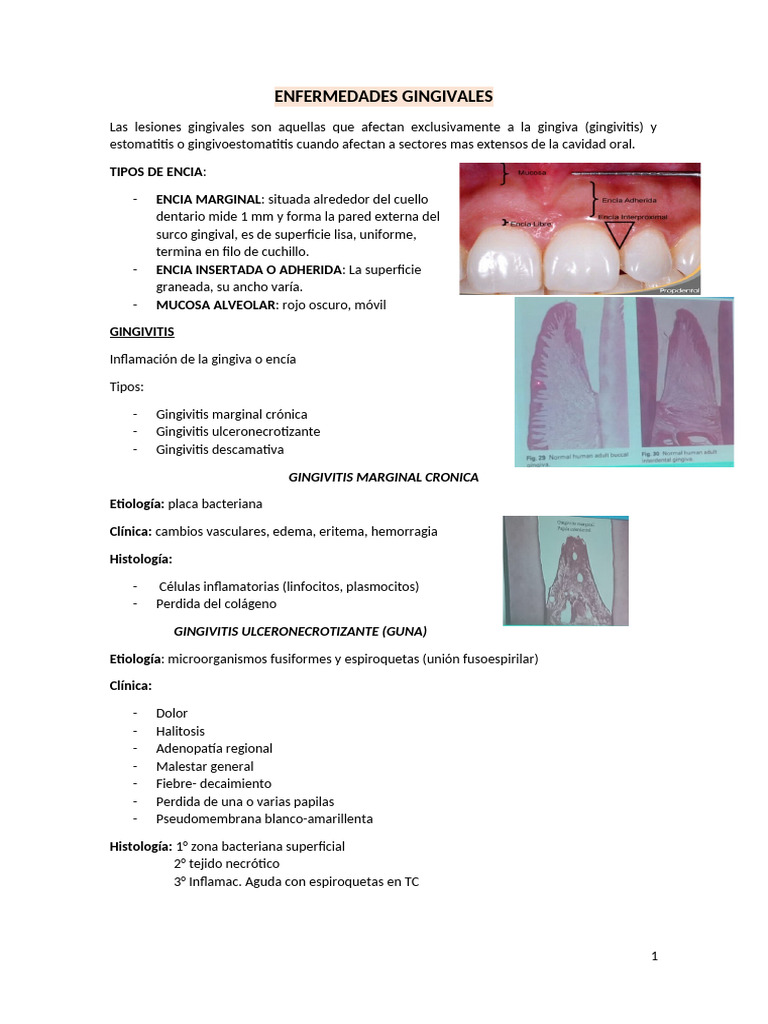 Enfermedades Gingivales: Tipos y Tratamientos | PDF | Enfermedades y ...