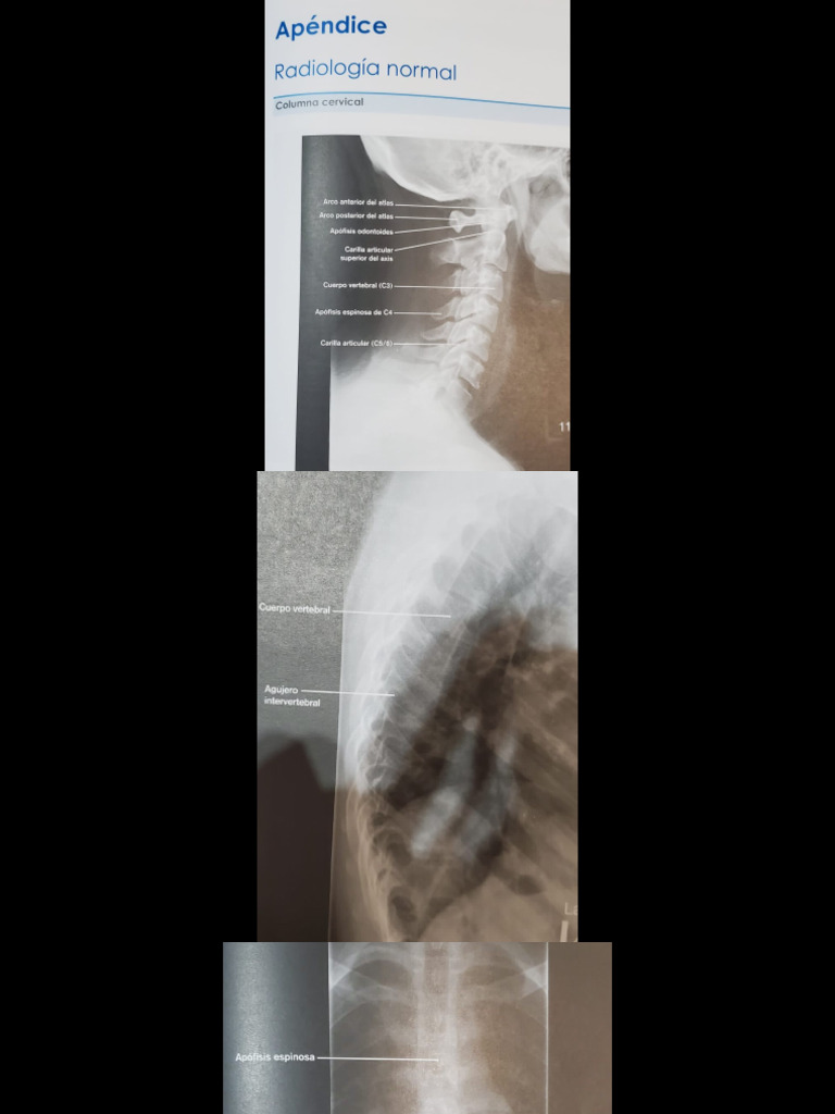 RX Normales Anatomía Michelshon | PDF