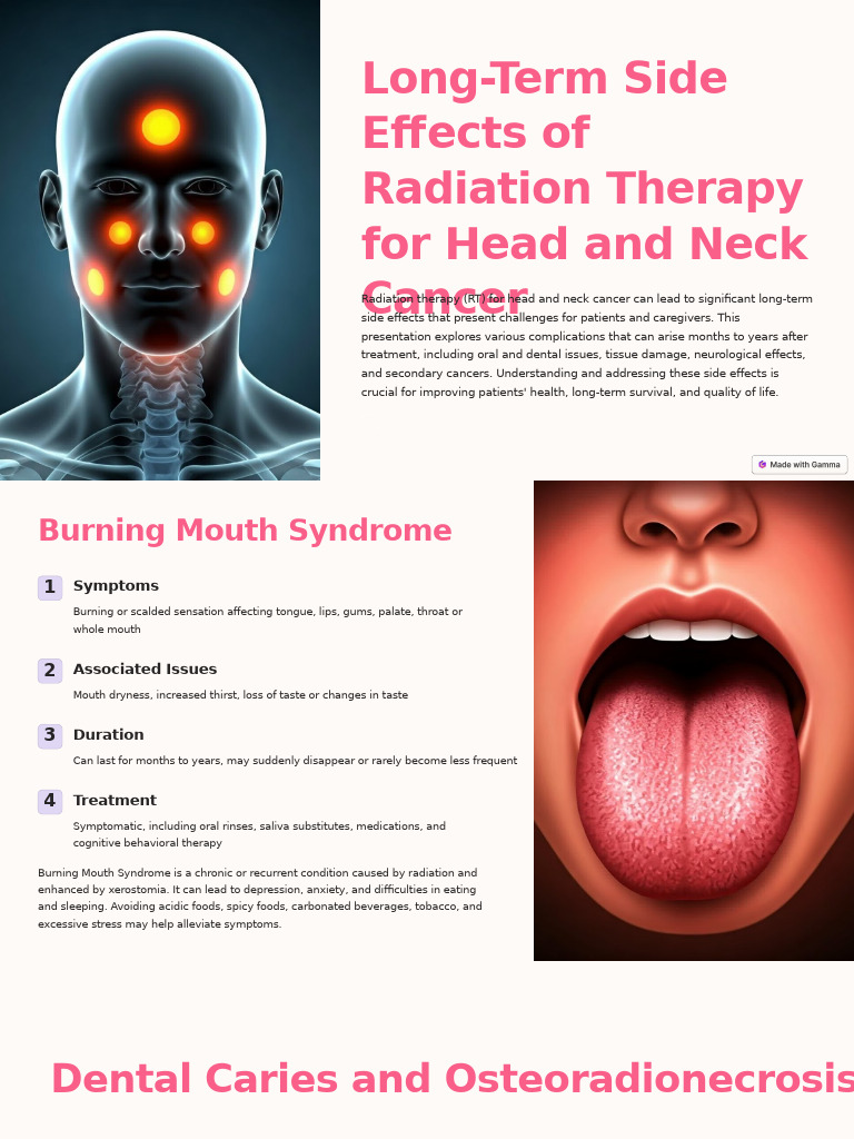 Long-Term Effects of Head and Neck RT | PDF | Head And Neck Cancer ...