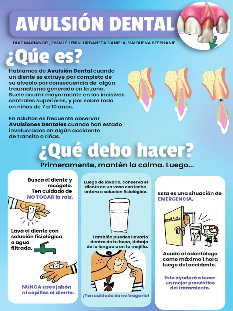 Guía de Emergencia para Avulsión Dental | PDF