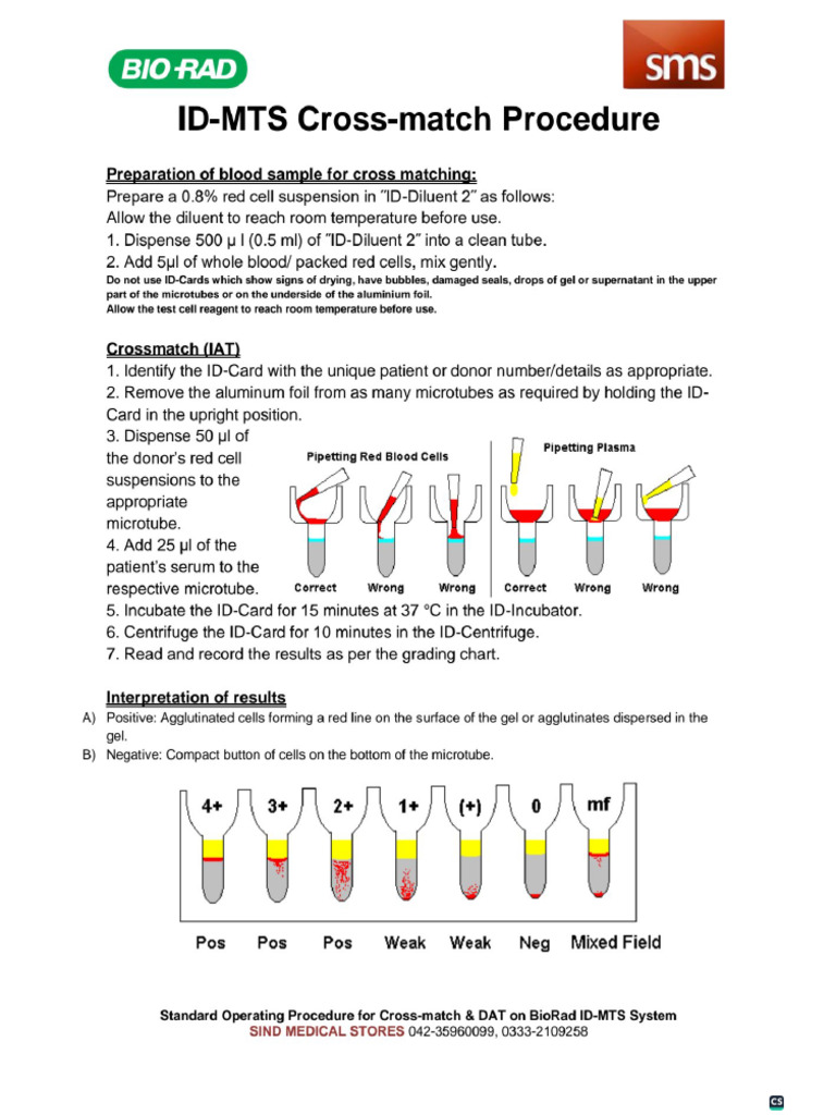 Sop Cross-Match | PDF