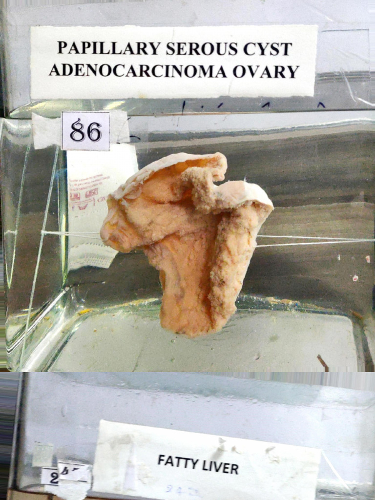 Pathology Specimens 1 December | PDF