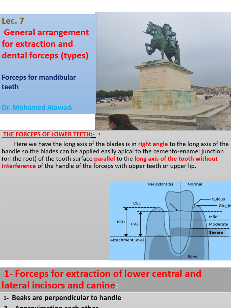 Mandibular Forceps for Tooth Extraction | PDF | Dental Anatomy | Dentistry
