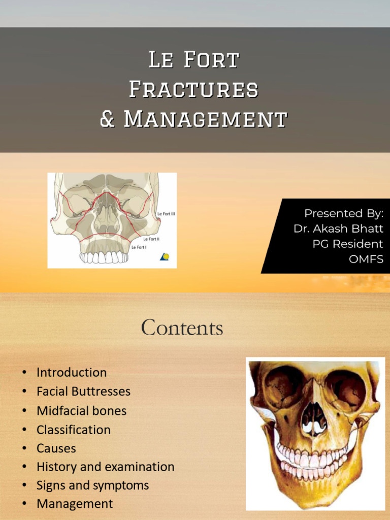 LE FORT FRACTURE | PDF | Skull | Human Anatomy