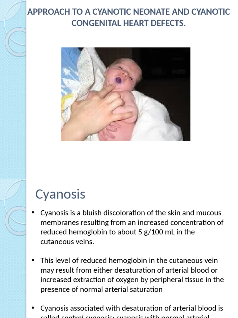 Approach To Cyanosis REWIND | PDF | Heart | Medical Specialties