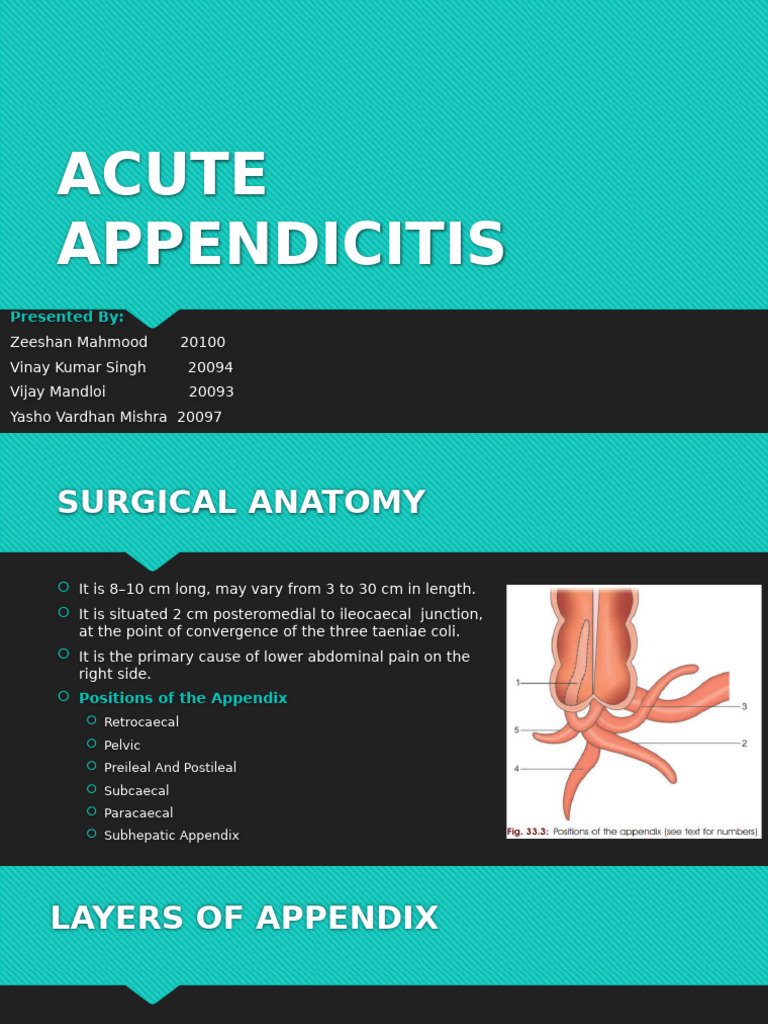 Acute Appendicitis Updated | PDF | Clinical Medicine | Diseases And ...
