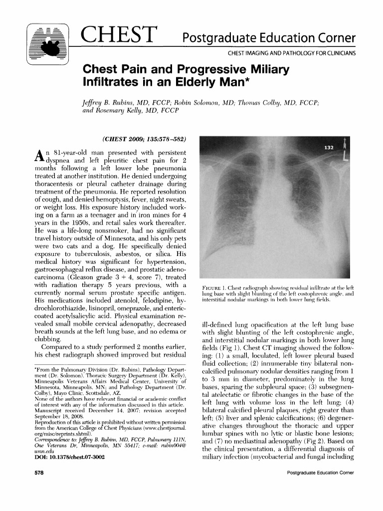 Chest Pain and Progressive Miliary Infiltrates in | PDF | Metastasis ...