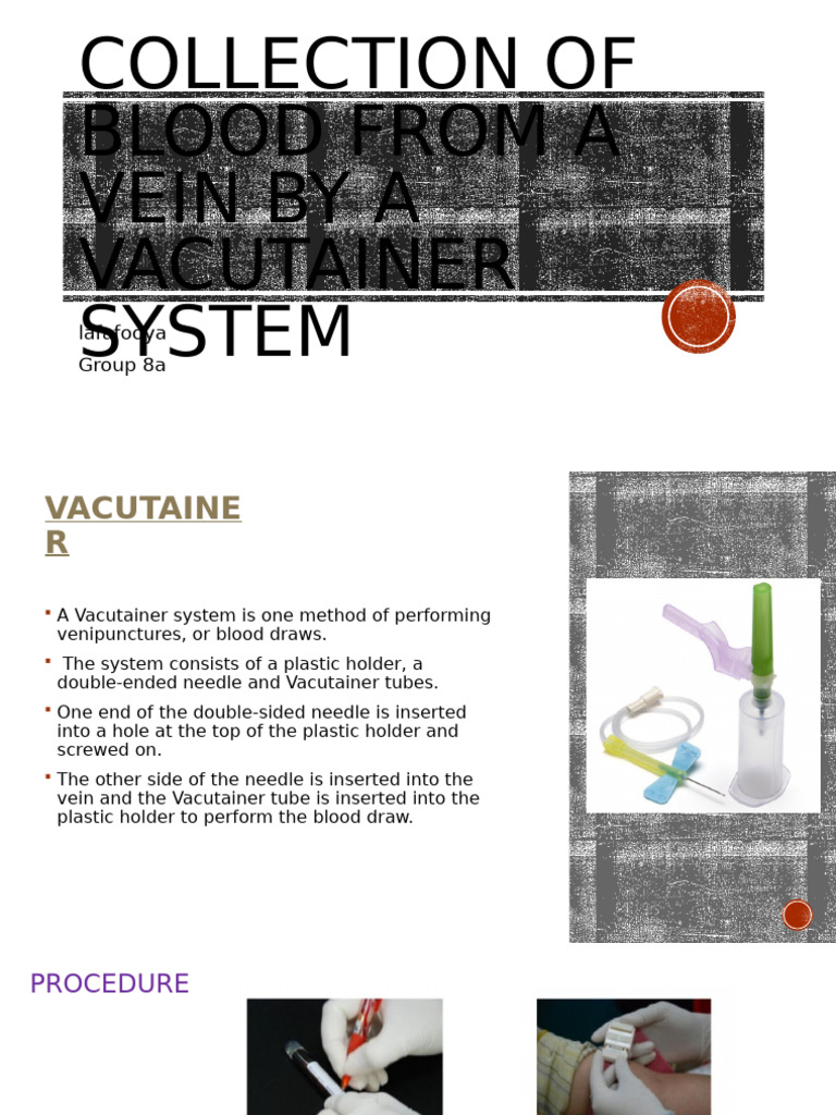 Collection of Blood From A Vein by A Vacutainer System | PDF