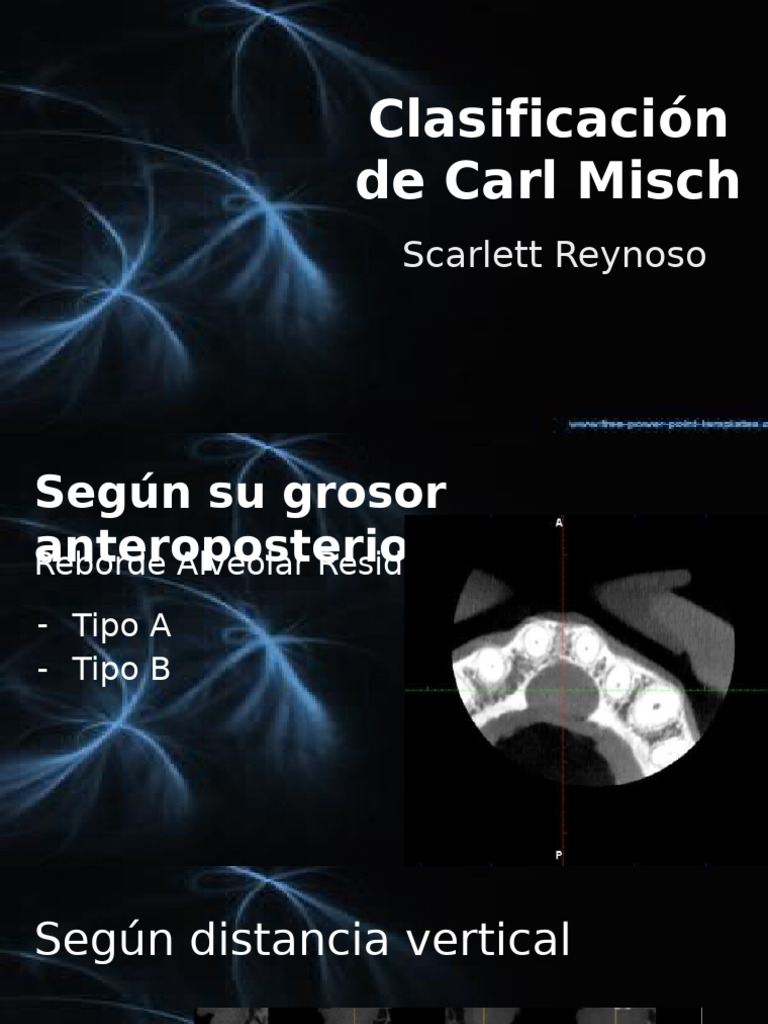 Clasificación de Carl Misch, Sca | PDF