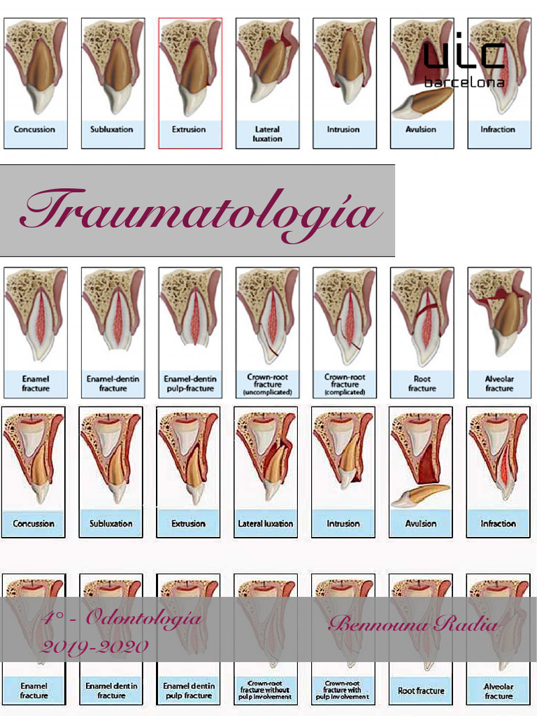 Traumatologia Completo | PDF | Diente humano | Ramas de Odontología