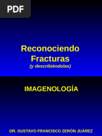 Clasificación de Fernández para Fracturas de Radio | PDF