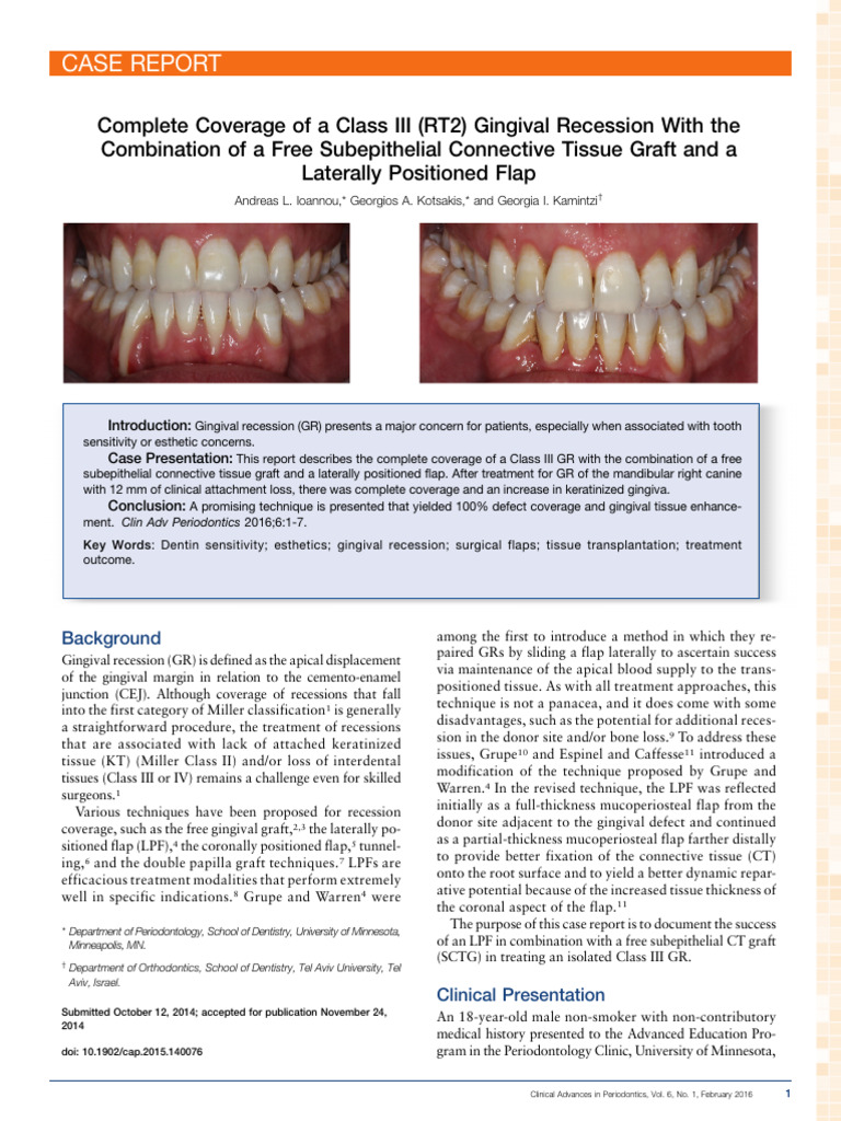 Complete Coverage of A Class III | PDF | Periodontology | Dental Anatomy
