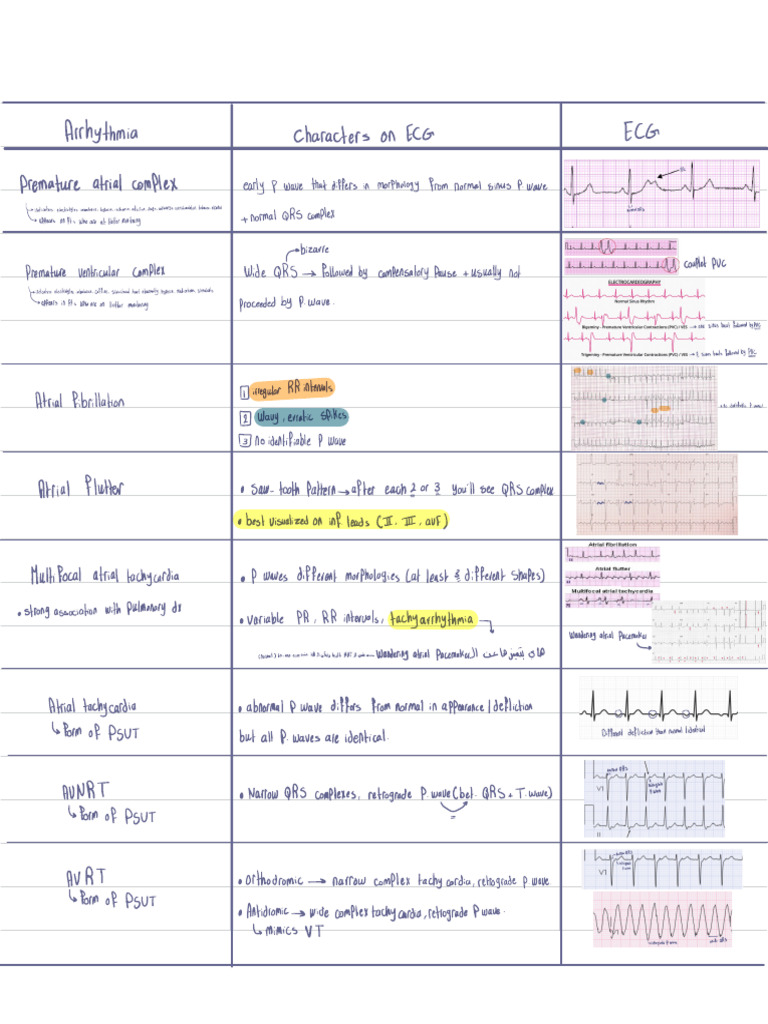 Ecg Changes | PDF | Electrocardiography | Cardiology