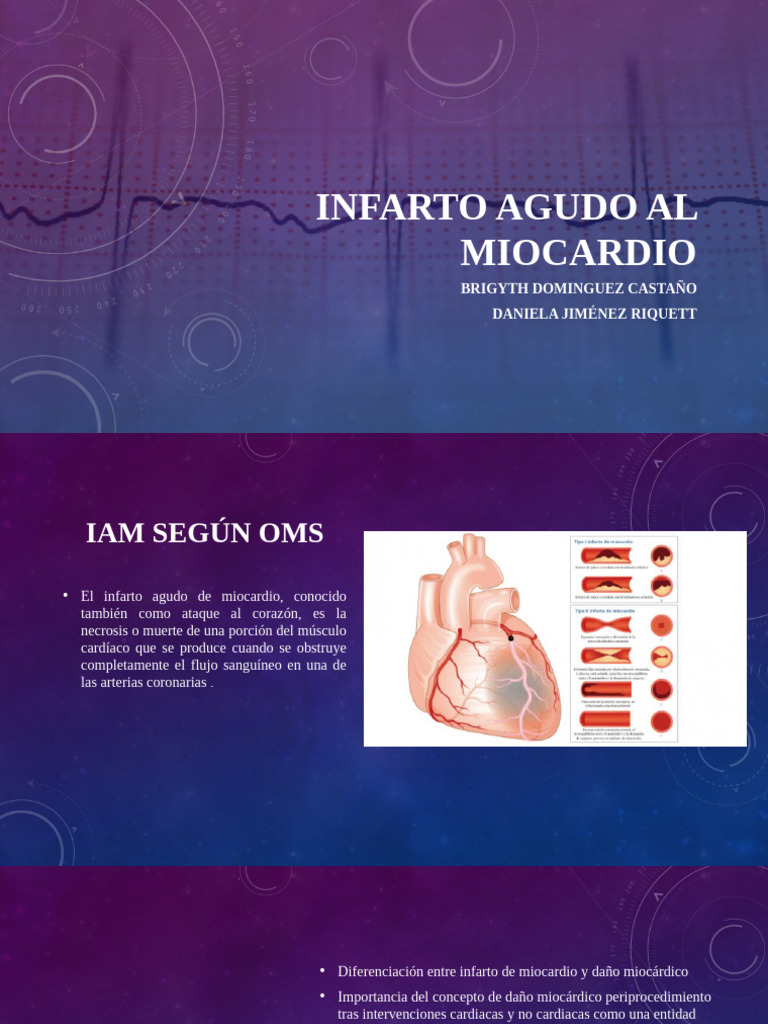 Infarto Agudo Al Miocardio | PDF | Infarto de miocardio ...