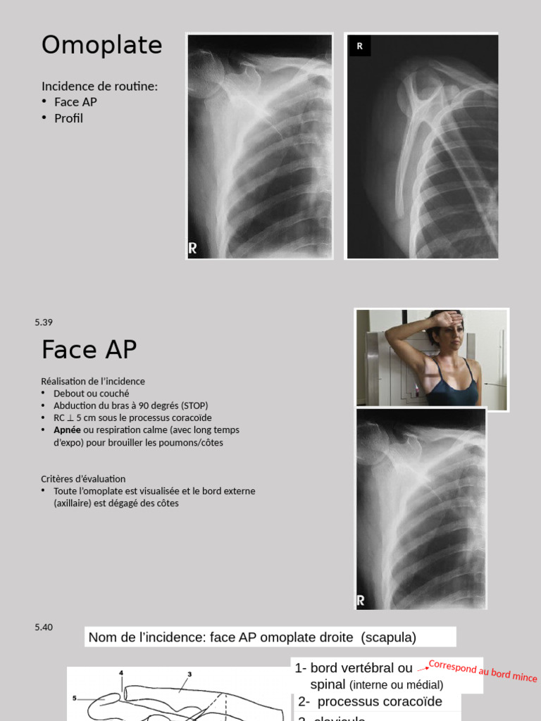 Incidences Radiologiques de l'Omoplate | PDF
