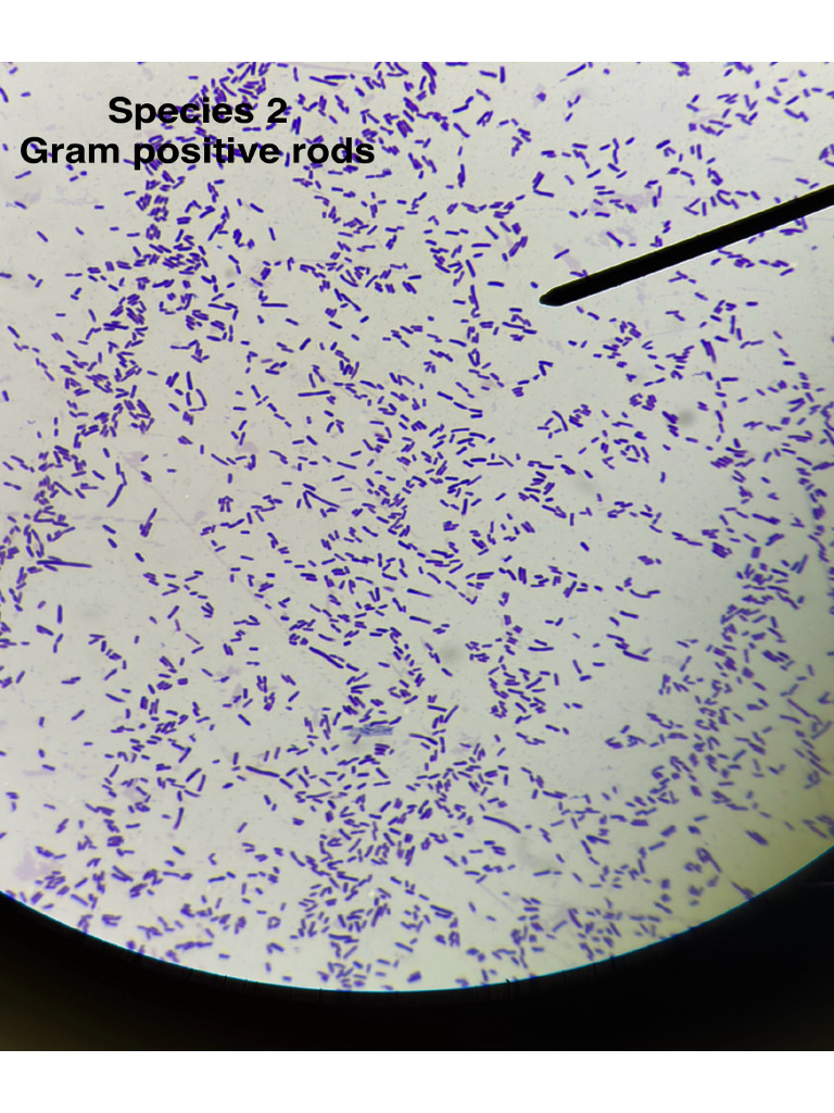 Gram Positive Rods | PDF
