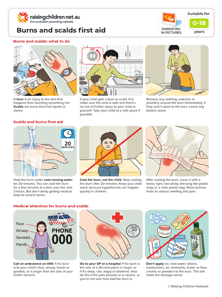 First Aid for Burns and Scalds in Kids | PDF | Burn | Medical Specialties