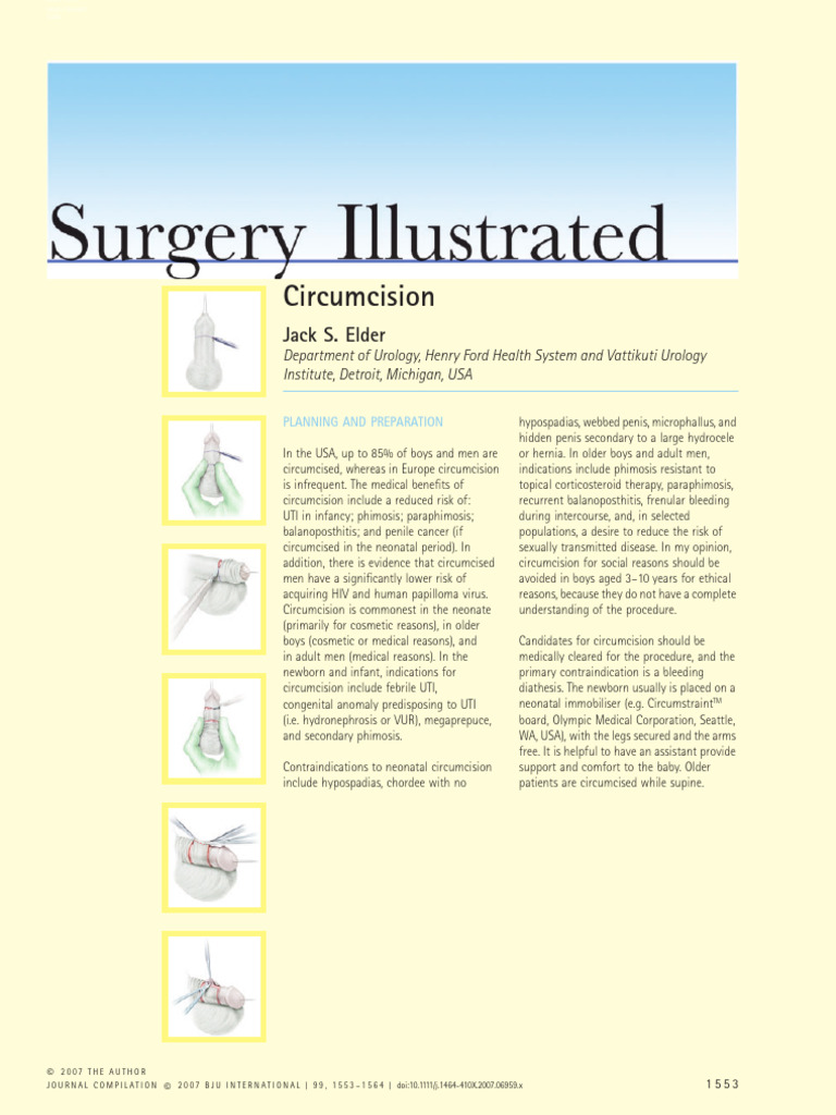Types and Techniques of Circumcision | PDF | Circumcision | Clinical ...