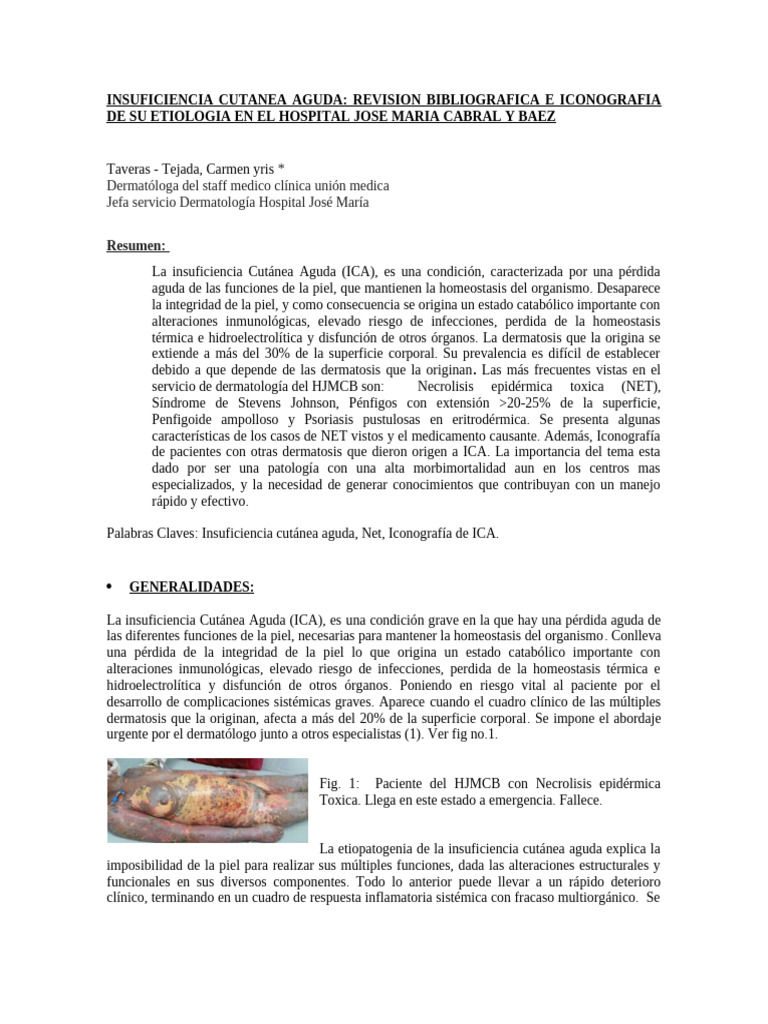 Insuficiencia Cutánea Aguda: Causas y Tratamiento | PDF | Enfermedades ...