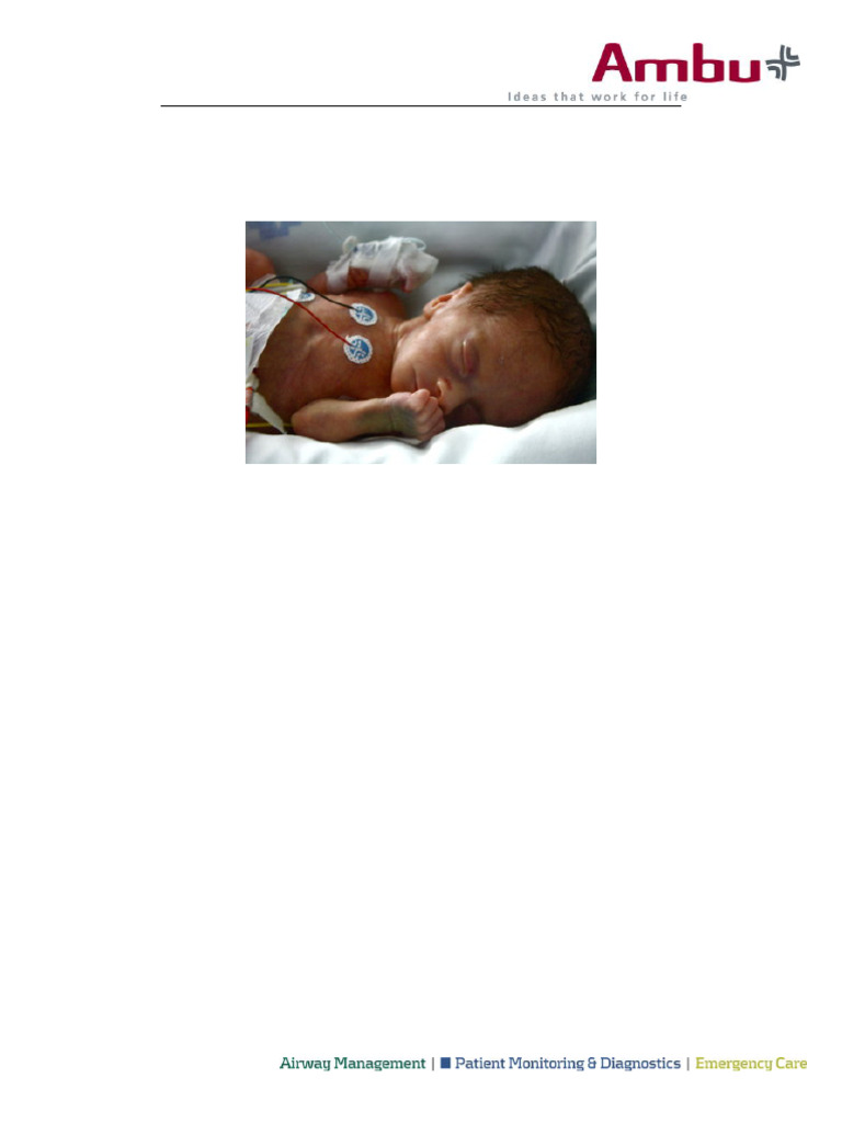 Neonatal Monitoring NICU | PDF | Neonatal Intensive Care Unit | Infants