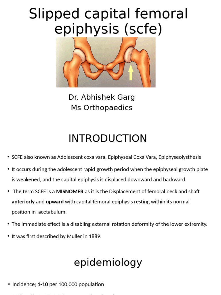 Slipped Capital Femoral Epiphysis (SCFE) | PDF | Anatomical Terms Of ...