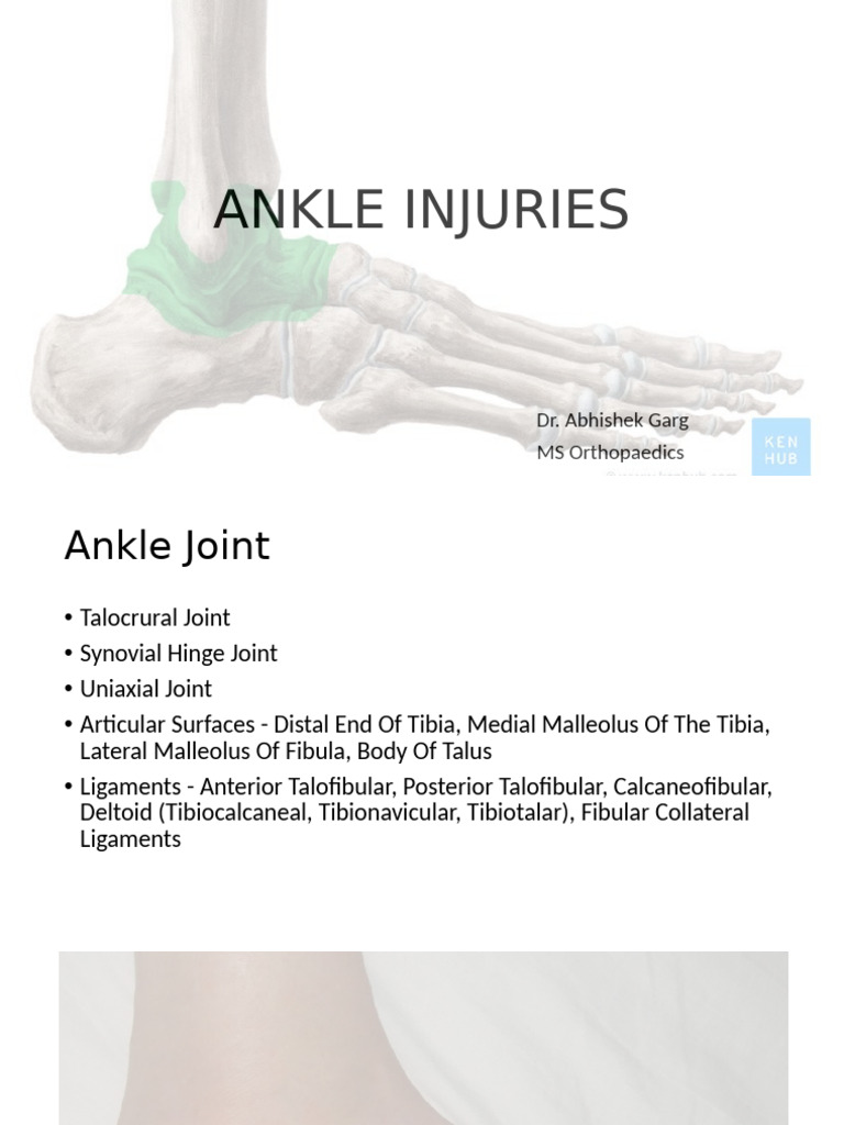 Ankle Sprain | PDF | Ankle | Lower Limb Anatomy