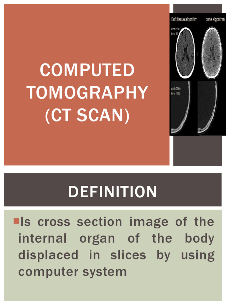 Computed Tomography | PDF