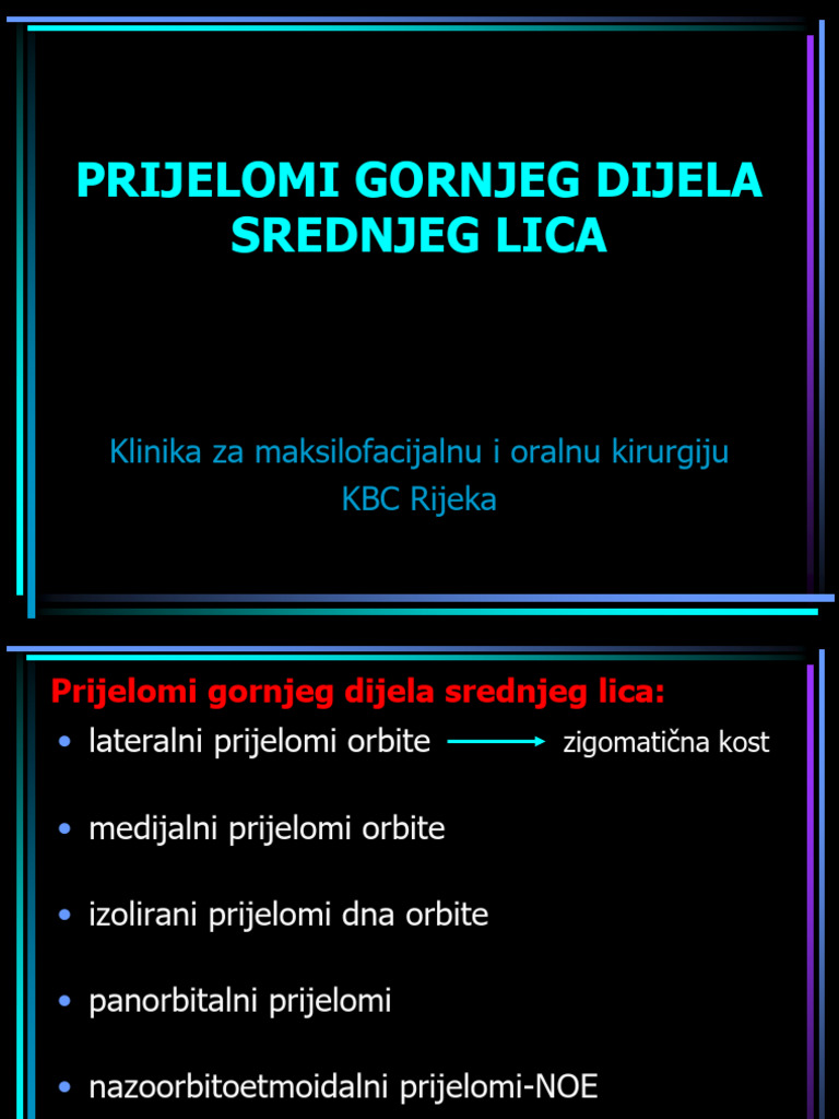 Prijelomi Gornjeg Dijela Srednjeg Lica | PDF