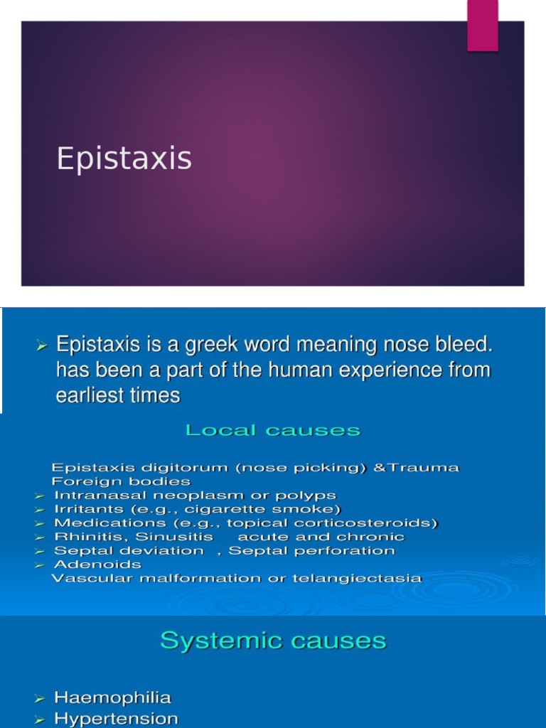 Epistaxis | PDF