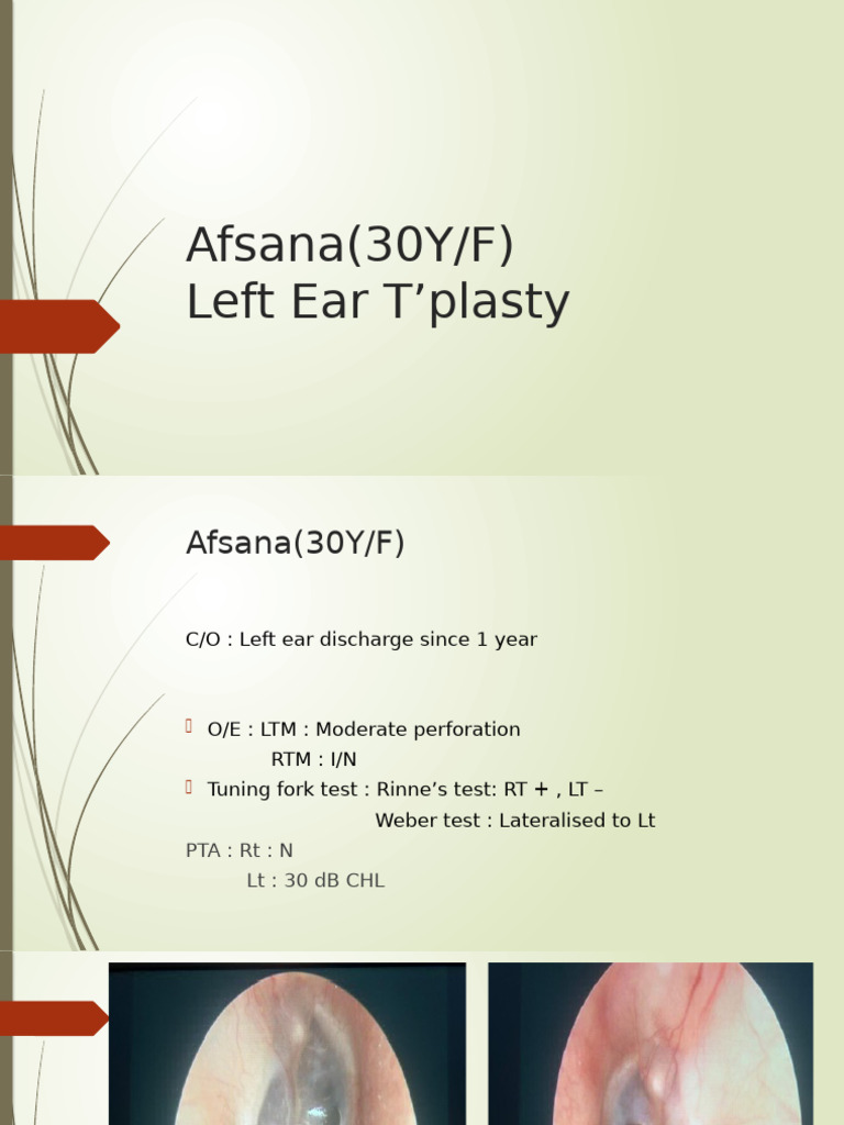 Afsana Tplasty | PDF