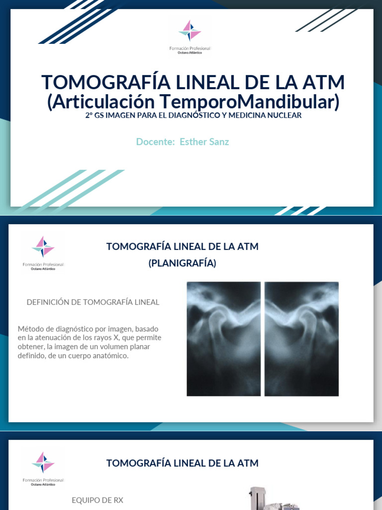 Tomografía Lineal de la ATM: Guía Diagnóstica | PDF