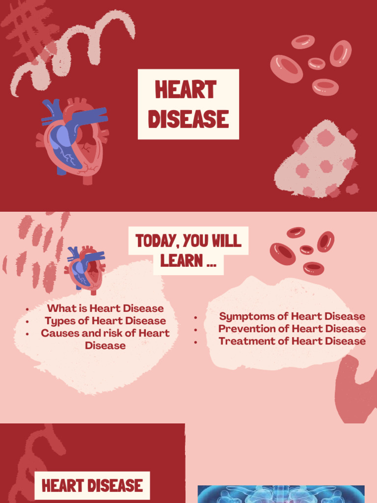 Understanding Heart Disease: Types & Care | PDF
