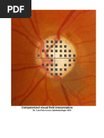 Confrontation Visual Fields - A Guide For Ophthalmologists in Training ...
